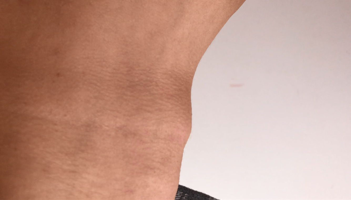 鱼刺卡住喉咙了? 别急, 教你快速去刺, 只需10秒就能好