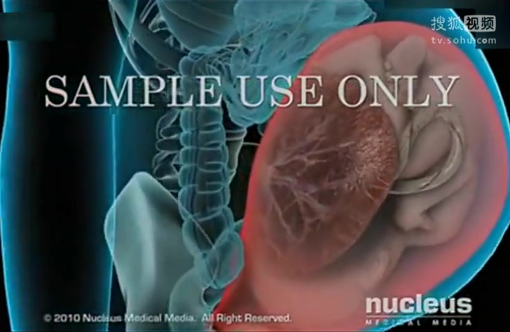 女人自然分娩真实动画过程,包括侧切术