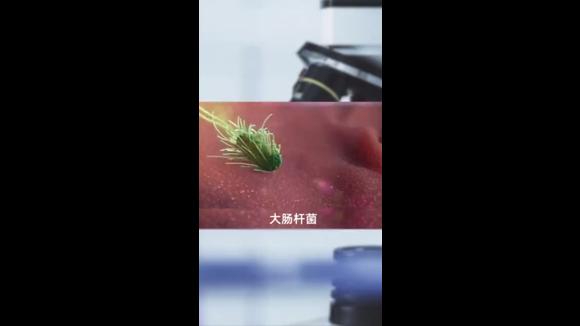画面太棒!巨噬细胞吞噬大肠杆菌,毫无悬念的战斗!