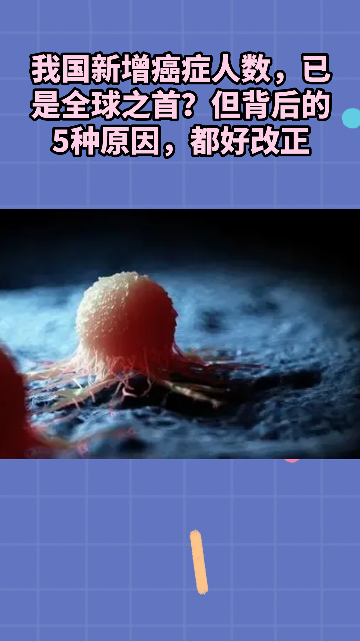 我国新增癌症人数,已是全球之首?但背后的5种原因,都好改正
