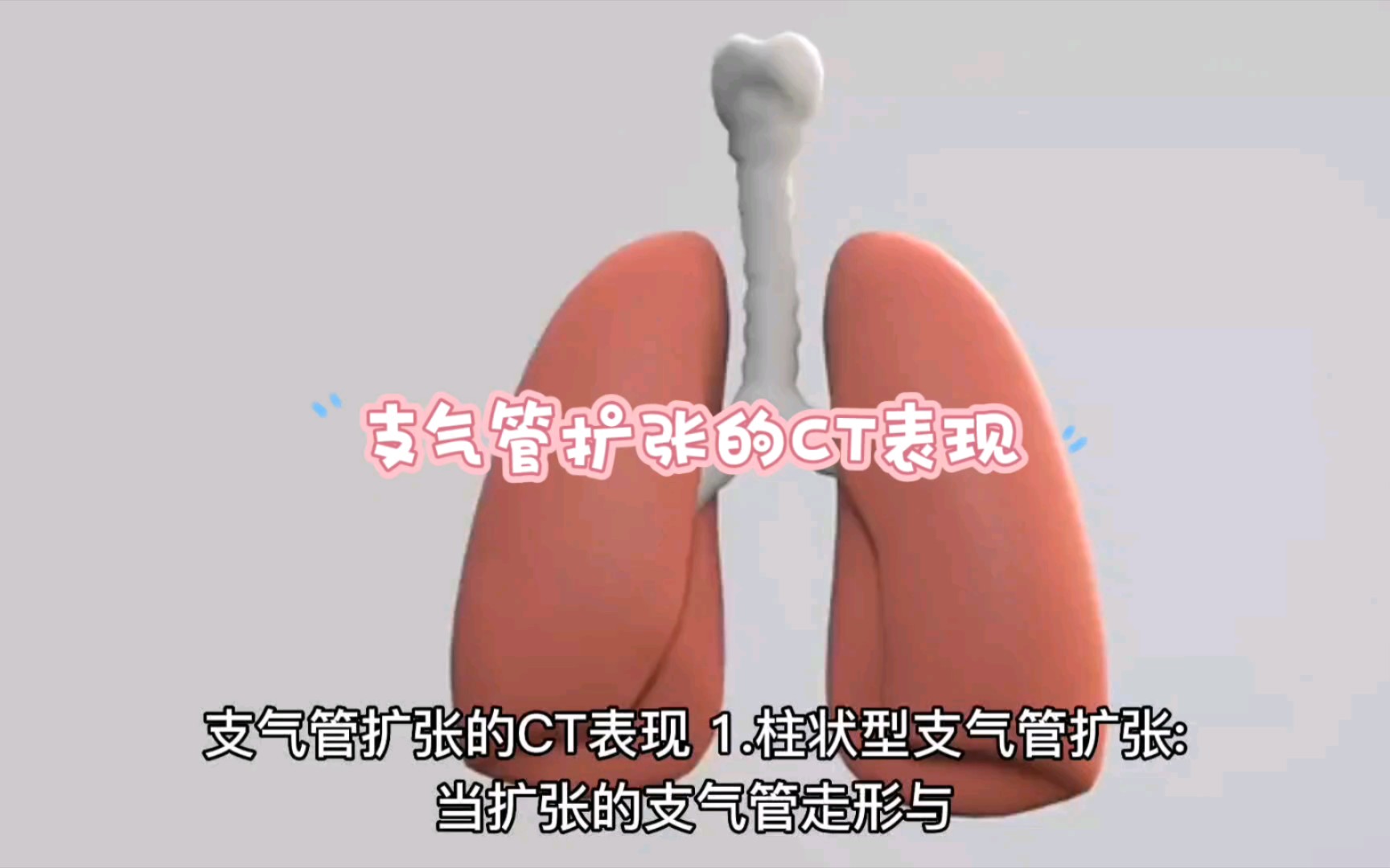 支气管扩张的CT表现