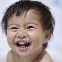 共济失调重症肌无力 