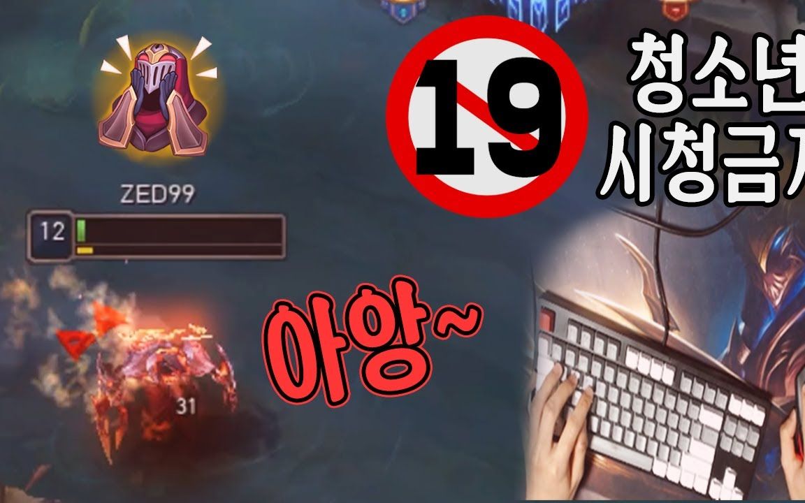 【渣翻/zed99】对线阿卡丽,手部特写,这是否有点儿…