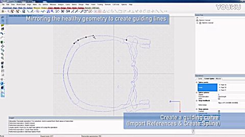 MIMICS 3-matic 教程 颅骨 修复 补片设计