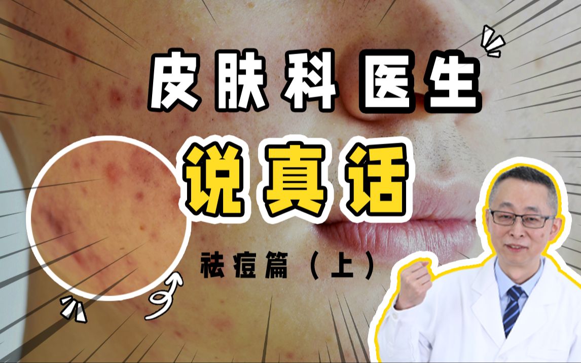 【皮肤科教授】假如皮肤科医生说真话!祛痘篇!传说中的“痘根”是...