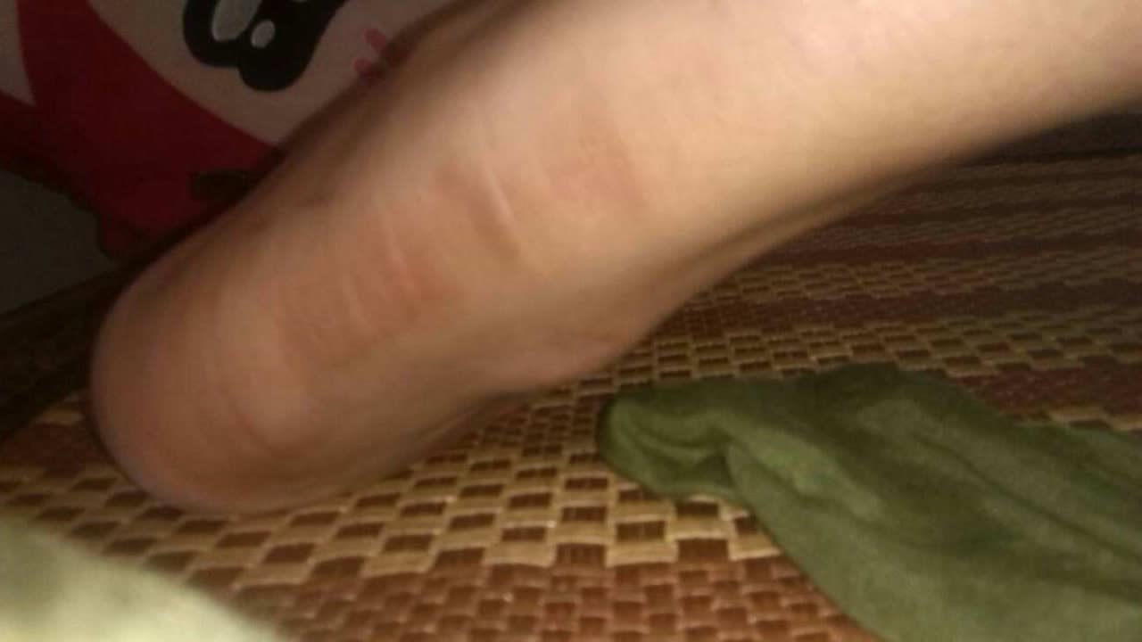 生活中简单去死皮的小窍门,好多人还不清楚,有需要的快点看看