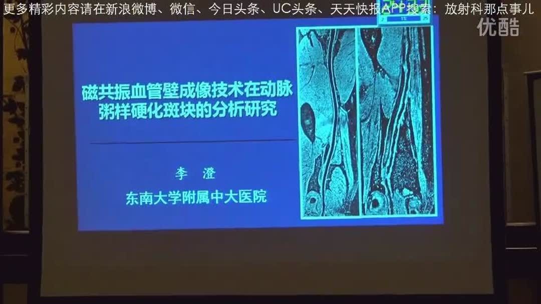 听影像大咖讲:磁共振血管壁成像在动脉粥样硬化斑块的分析研究