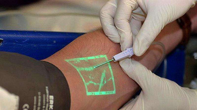 国引进打针神器,往手腕上一放血管就出来!以后再也不怕扎针了!