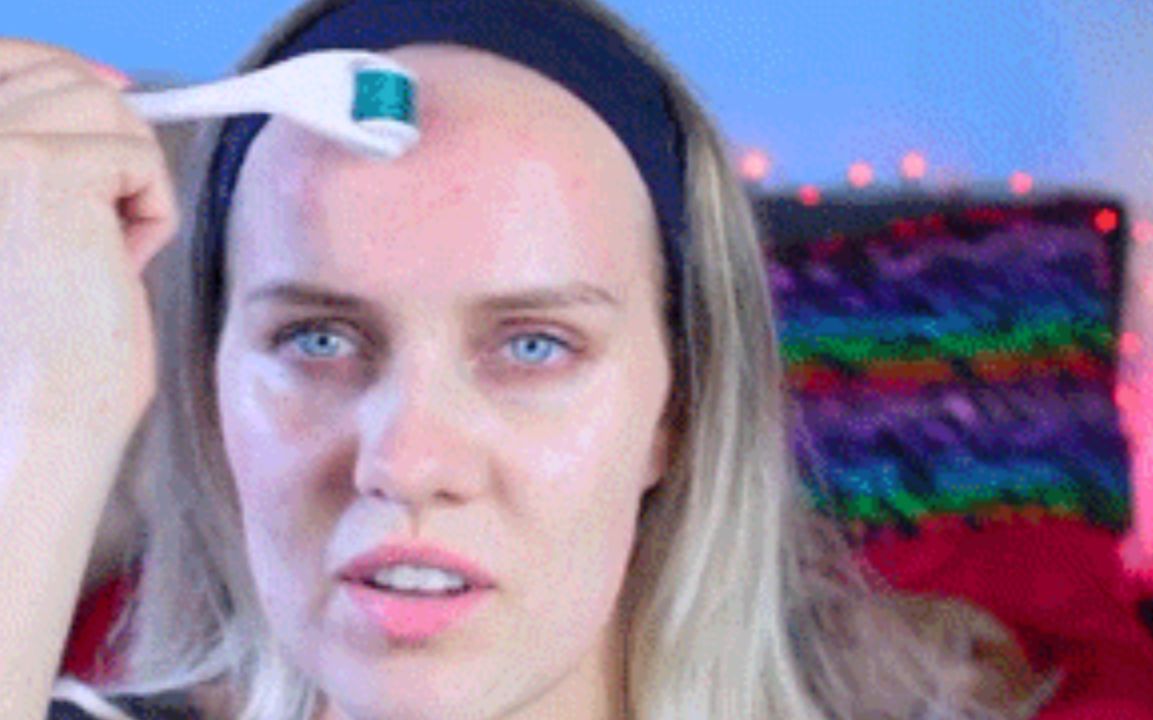 脸皮重获新生?微针真的那么神奇吗?