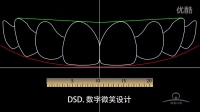 DSD数字微笑设计