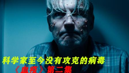 你知道世界上最致命的病毒是什么吗?