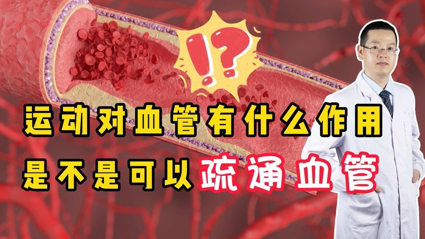 运动对血管有什么作用?真的可以疏通血管吗?听听医生怎么说