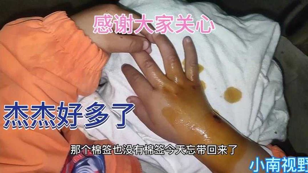 很担心杰杰!被狗咬过会不会留后遗症