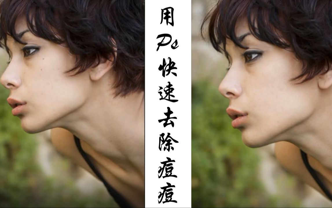 【Photoshop教学】如何用Ps快速去除痘痘伤疤