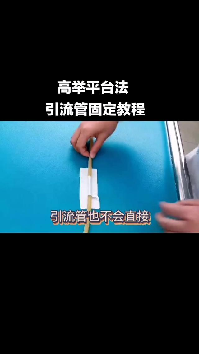 高举平台法引流管固定教程#护理 #外科#护士懂护士 #实习护士