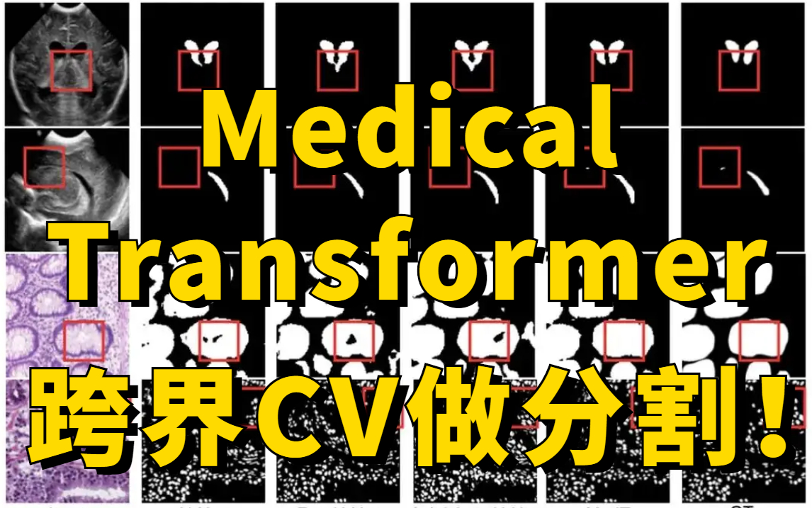 ...分割:基于MedicalTransformer的医学图像分割实战!论文精读+源码复现!