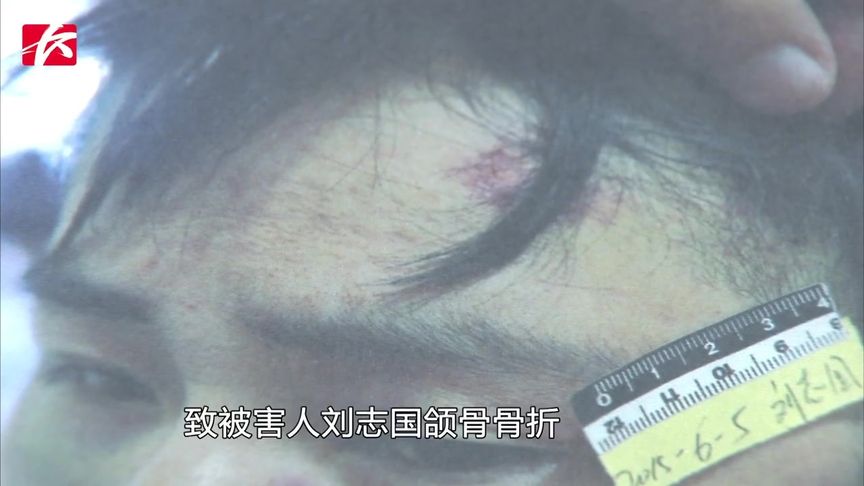 帮朋友强出头拿酒瓶帮忙打斗致人轻伤,男子获刑1年