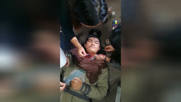 现在的电视剧越来越厉害了,看这伤口做得简直跟真的一模一样