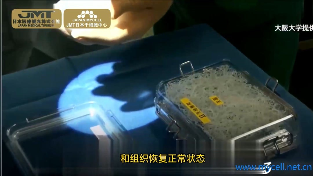 JMT日本干细胞-日本干细胞发展方向