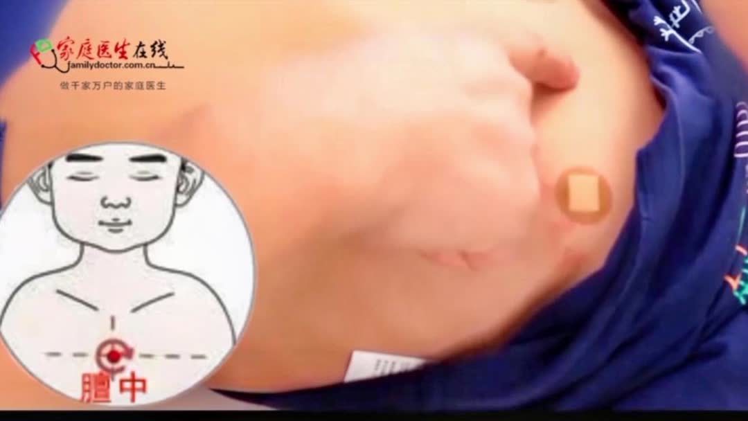 小儿风热咳嗽很难受?这样推拿好得快,风热咳嗽推拿操(视频教学)