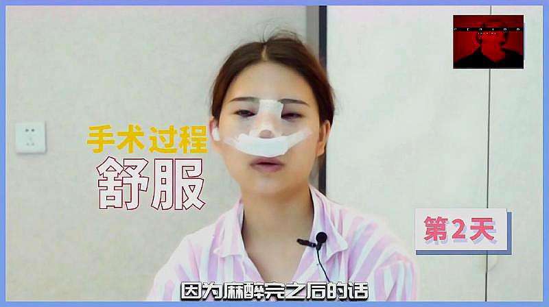 成都鼻综合整形手术前全过程记录,项目:耳软骨垫鼻尖+假体隆鼻