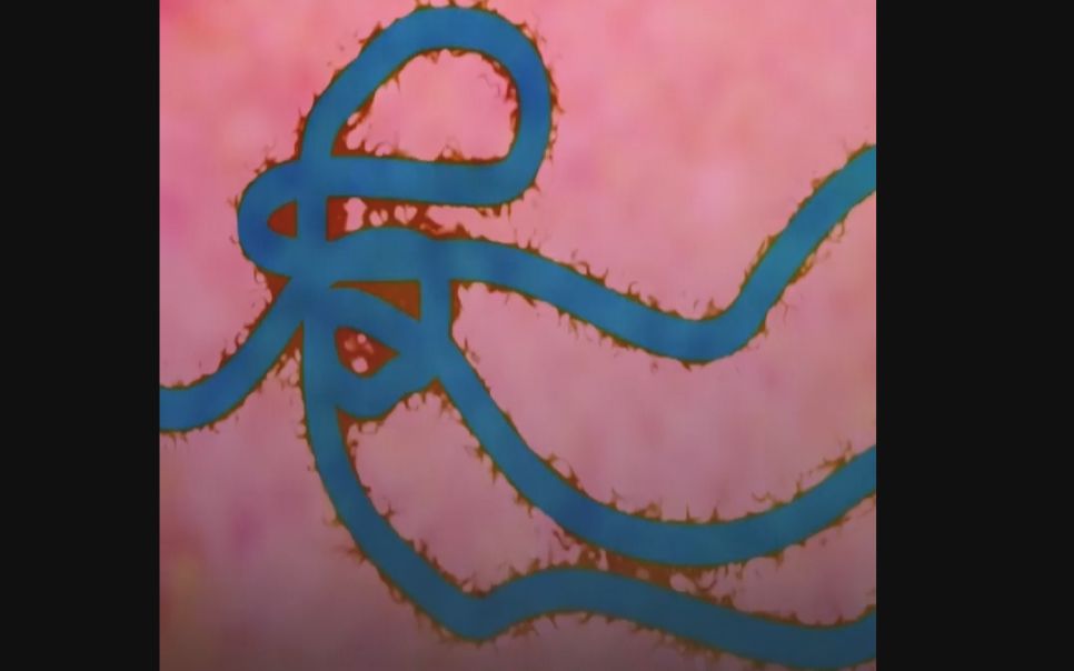 地球上最致命的10种病毒