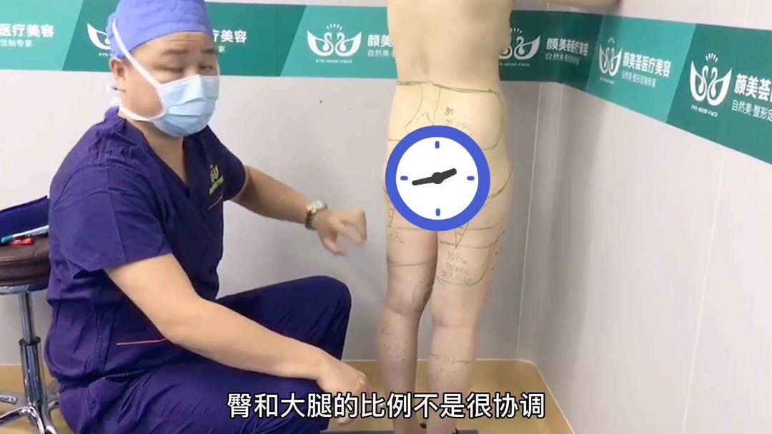 张胜昌说脂肪|小蛮腰塑型-射肉毒素瘦小腿术前分析