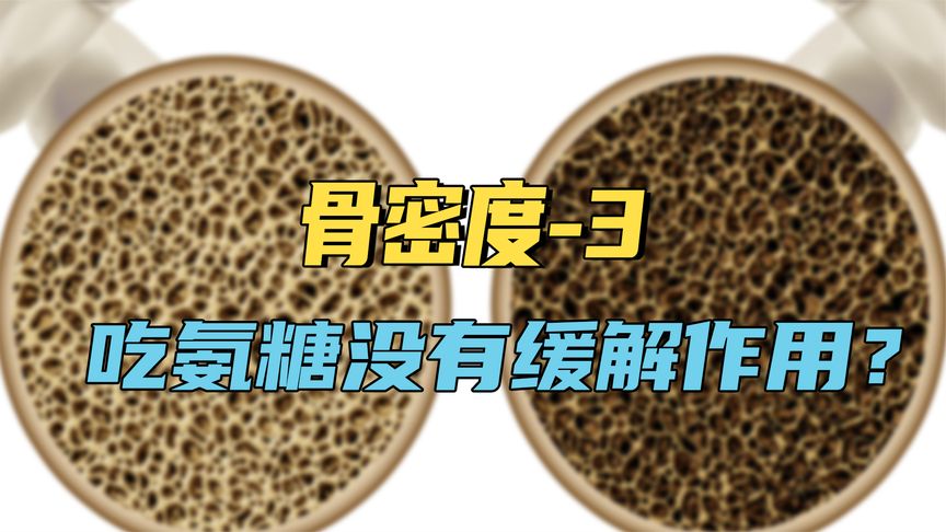 骨密度-3,骨质疏松症,吃氨糖对此有没有什么缓解作用?