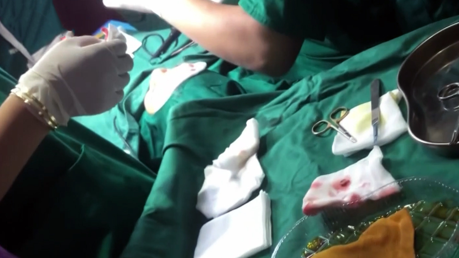 央视再曝医美乱象:器械不消毒,手术靠胆量