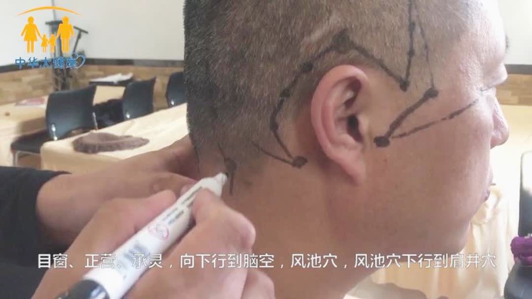 胆经44穴位置来了,解油脂、排肝气、妇科病、头疼都跟它有关!