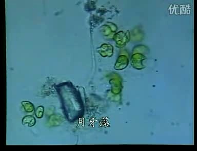 《观察一滴池塘水中的藻类植物》