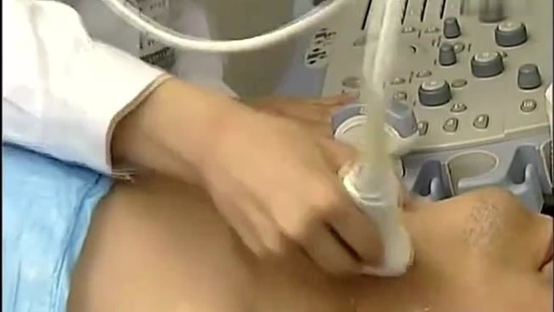 影像检查技术:颈部血管超声检查方法