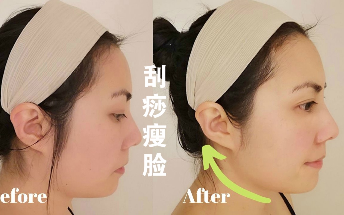 5分钟刮痧瘦脸|手把手教学亲测一周见效|小开Kelly