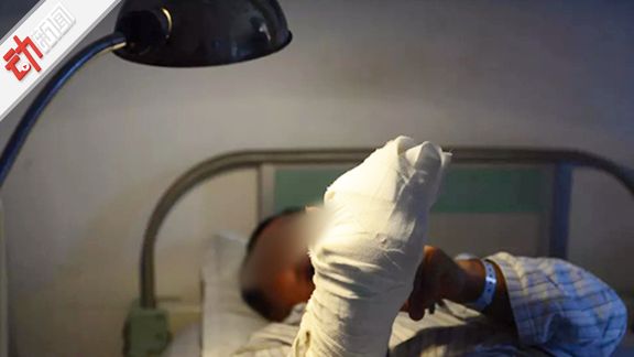 云南大叔手指被截断竟撒尿消毒 动画科普“土办法”不可取!