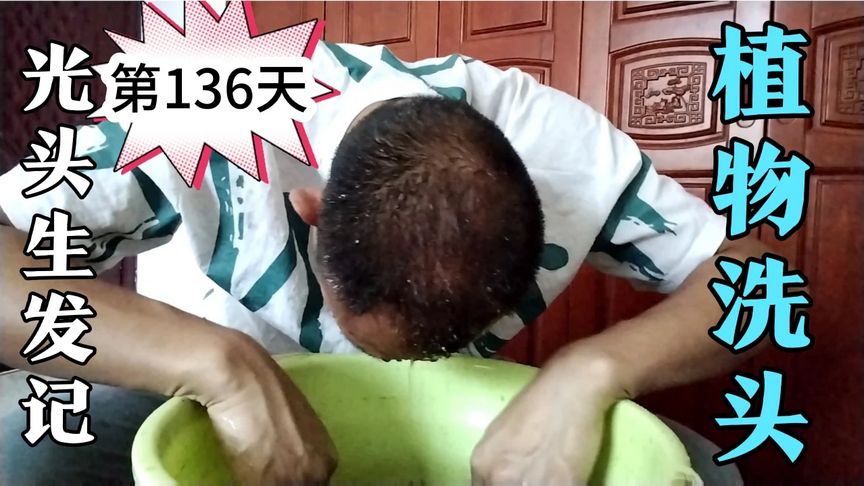 光头生发记,植物洗头第136天,为什么要每天多洗几次有什么好处