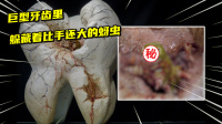 模型制作:巨型牙齿里,隐藏着可怕的蚜虫?