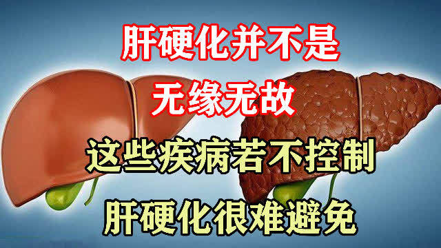 肝硬化并不是无缘无故,这些疾病若不控制,肝硬化很难避免