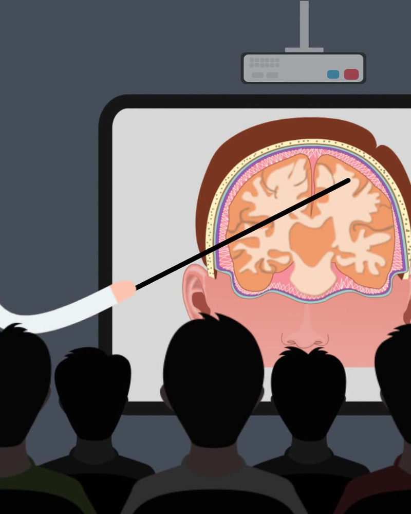 颅内感染是指细菌或病毒,进入颅骨等引起的感染!多出现这些症状