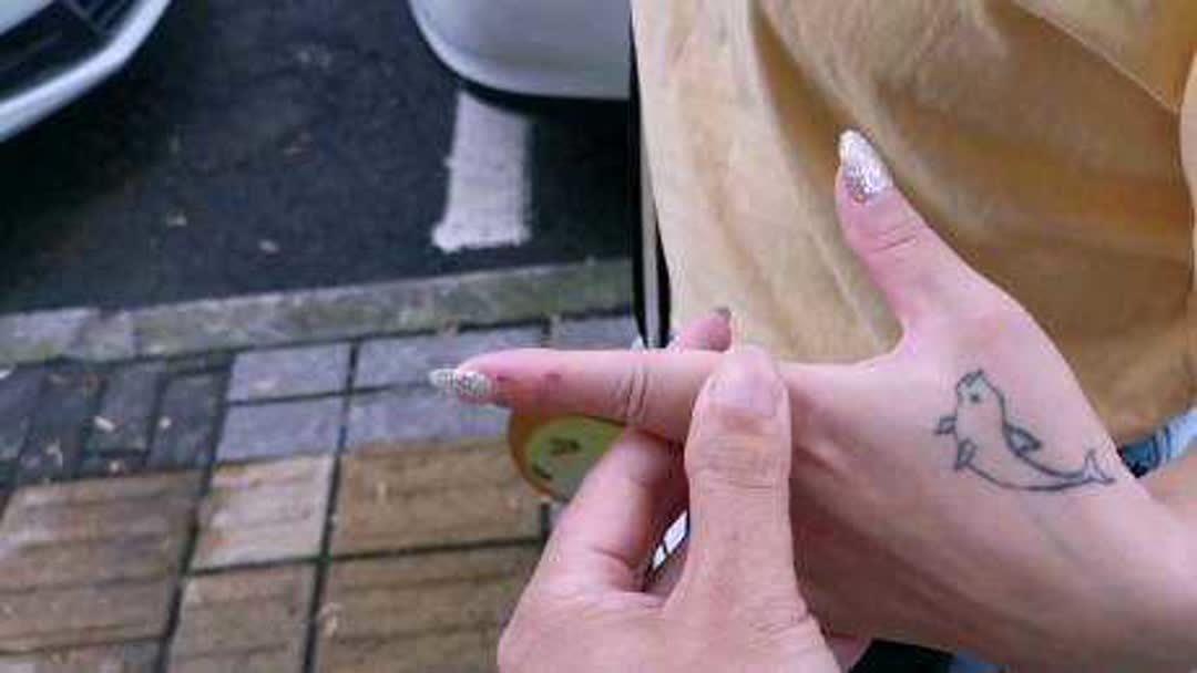 美女走亲戚,被狗咬伤,还不愿意去打狂犬病疫苗!