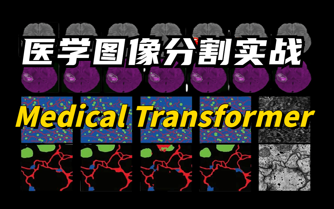 ...!从未见过如此通俗易懂的深度学习实战教程,论文精读+代码复现,讲得...