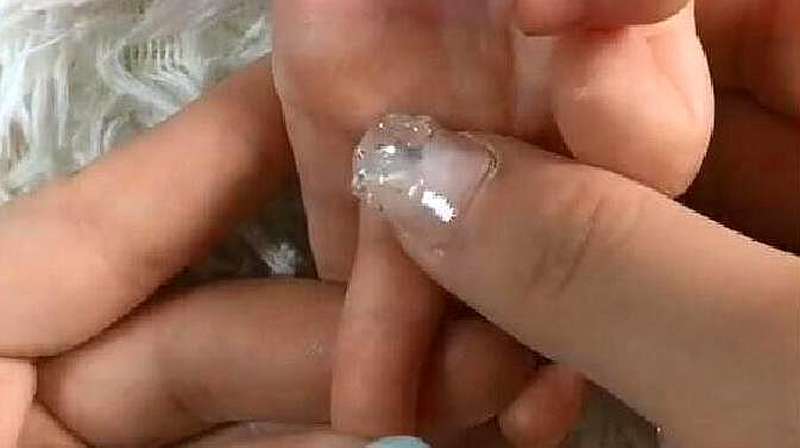 宝宝湿疹的推拿手法,清肺经,从指根推向指尖每天300次!