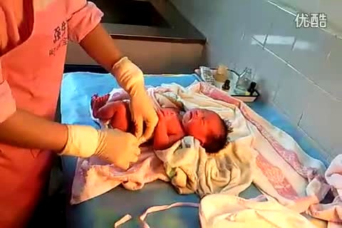 宝宝出生第二天第一次洗澡