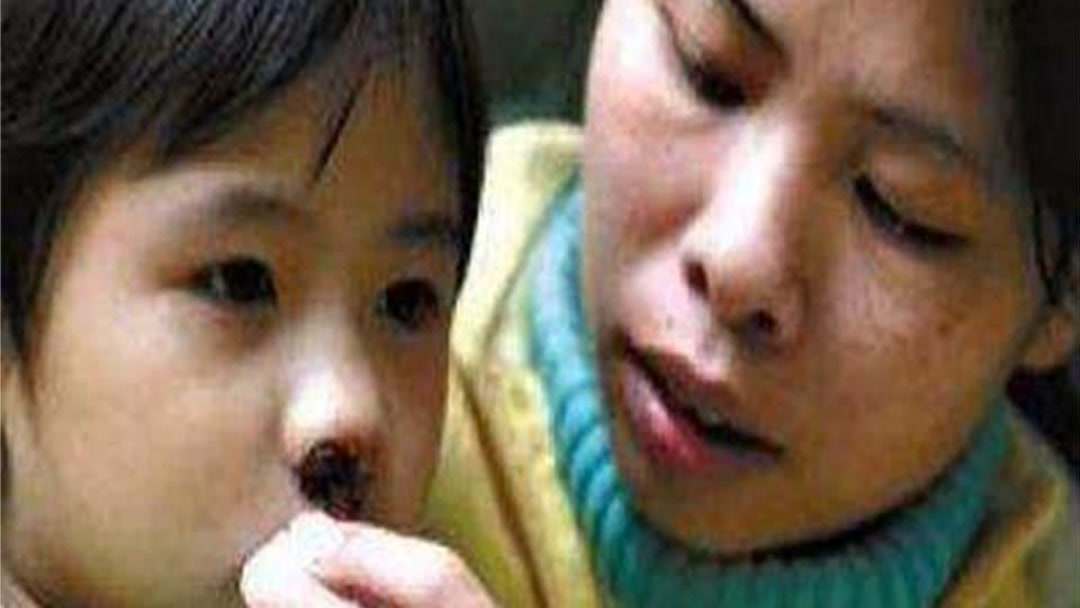 3岁女童不停流鼻血,医生检查后,竟然从鼻腔里取出一只“鞋”