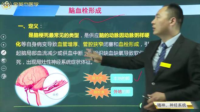 脑血管疾病:脑梗死的概念,脑血栓形成定义、病因及共同临床表现