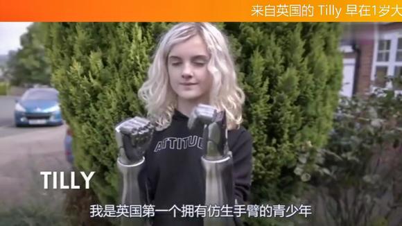 有多少正常手臂,敌不过这双机械仿生手臂