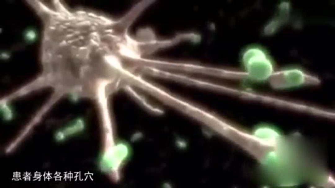 世界上最恐怖的病毒曾经杀死1.5亿人尸横遍野!