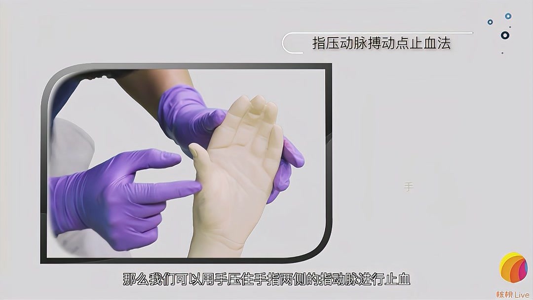 教给你如何对外伤出血的病人进行现场急救六
