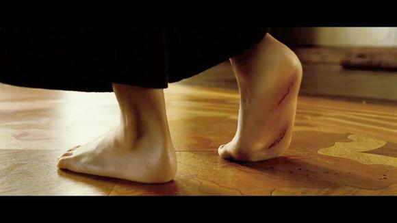 老师体罚学生,把学生脚掌打得皮开肉绽!太狠心了!