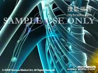 3D乳腺癌手术模拟(Breast Cancer Surgery Lumpectom,Mastectomy)