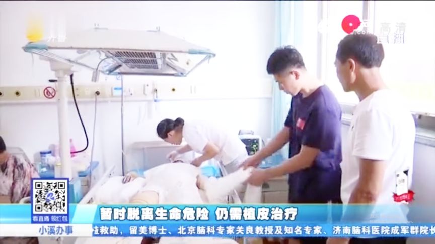 厨房煤气罐突然爆炸,大姐全身被烧伤85%,疼得躺在床上不停颤抖